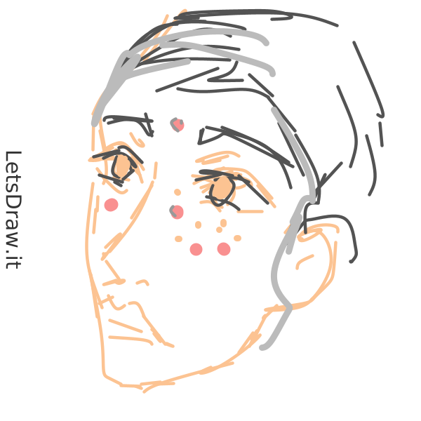 How to draw acne / 73jmkitwx.png / LetsDrawIt