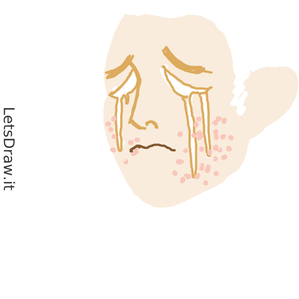 How to draw acne / cc6bx4i7z.png / LetsDrawIt