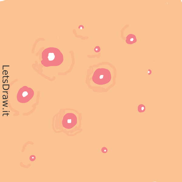 How to draw acne / ekdg1phwp.png / LetsDrawIt