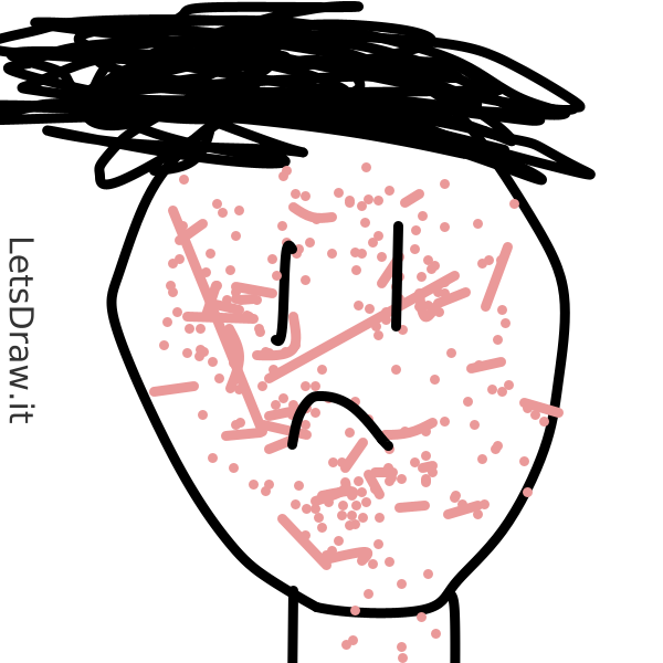 How to draw acne / ghj7eqncz.png / LetsDrawIt