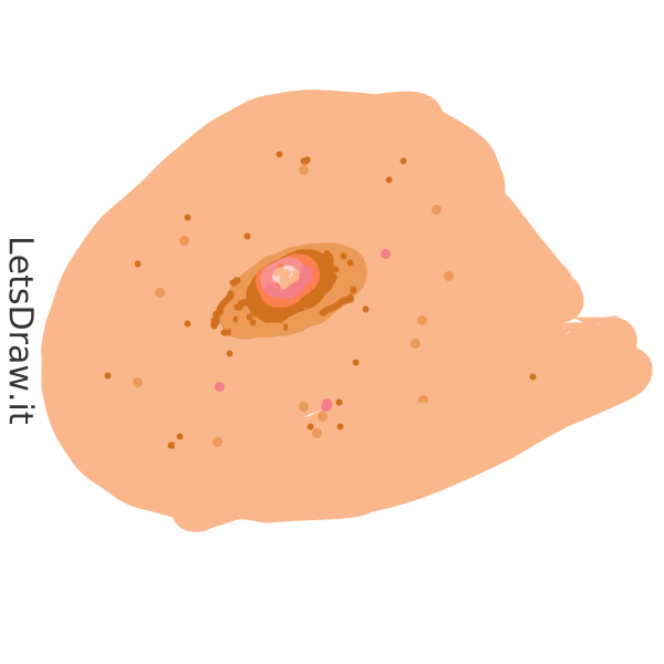 How to draw acne / nee5uq74t.png / LetsDrawIt