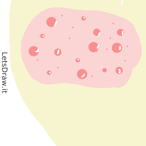 How to draw acne / o9pfwgwho.png / LetsDrawIt