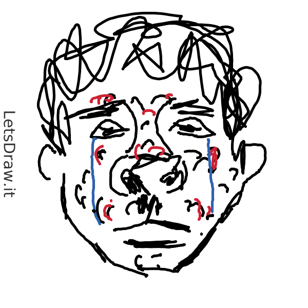 How to draw acne / oh8sbmkfi.png / LetsDrawIt