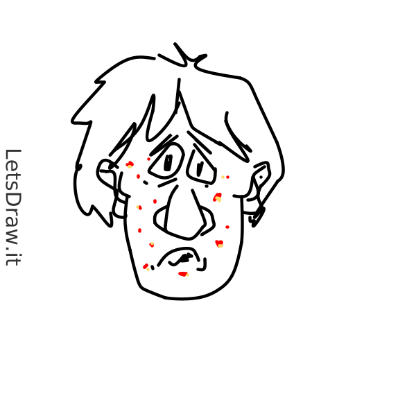 How to draw acne / y9sud9ray.png / LetsDrawIt