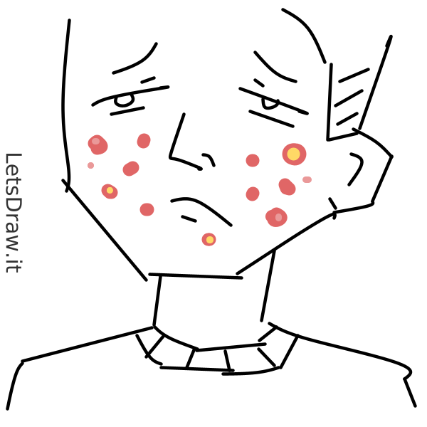 How to draw acne / zomp8944m.png / LetsDrawIt